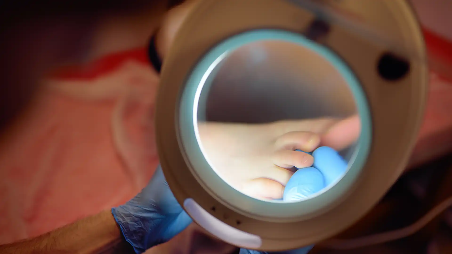 Signs of Ingrown Toenail Infection - Hills District Podiatry